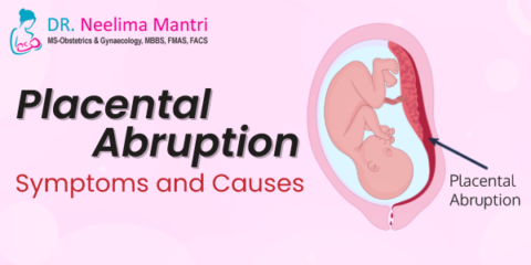 Placental Abruption Symptoms, Causes & Treatment