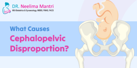 What Causes Cephalopelvic Disproportion? | Dr Neelima Mantri