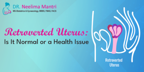 Know about Retroverted Uterus: Is It Normal or a Health Issue