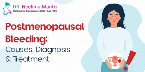 Postmenopausal Bleeding: Causes, Diagnosis and Treatment