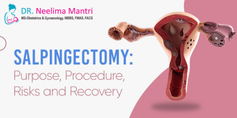 Salpingectomy: Purpose, Procedure, Risks and Recovery
