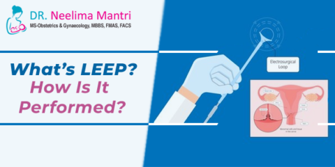 What’s LEEP? How Is It Performed? | Dr Neelima Mantri