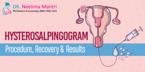 Hysterosalpingogram (HSG): Procedure, Recovery & Results - Best Female ...