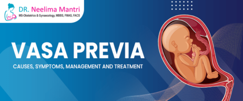 Vasa Previa: Causes, Symptoms, Management and Treatment